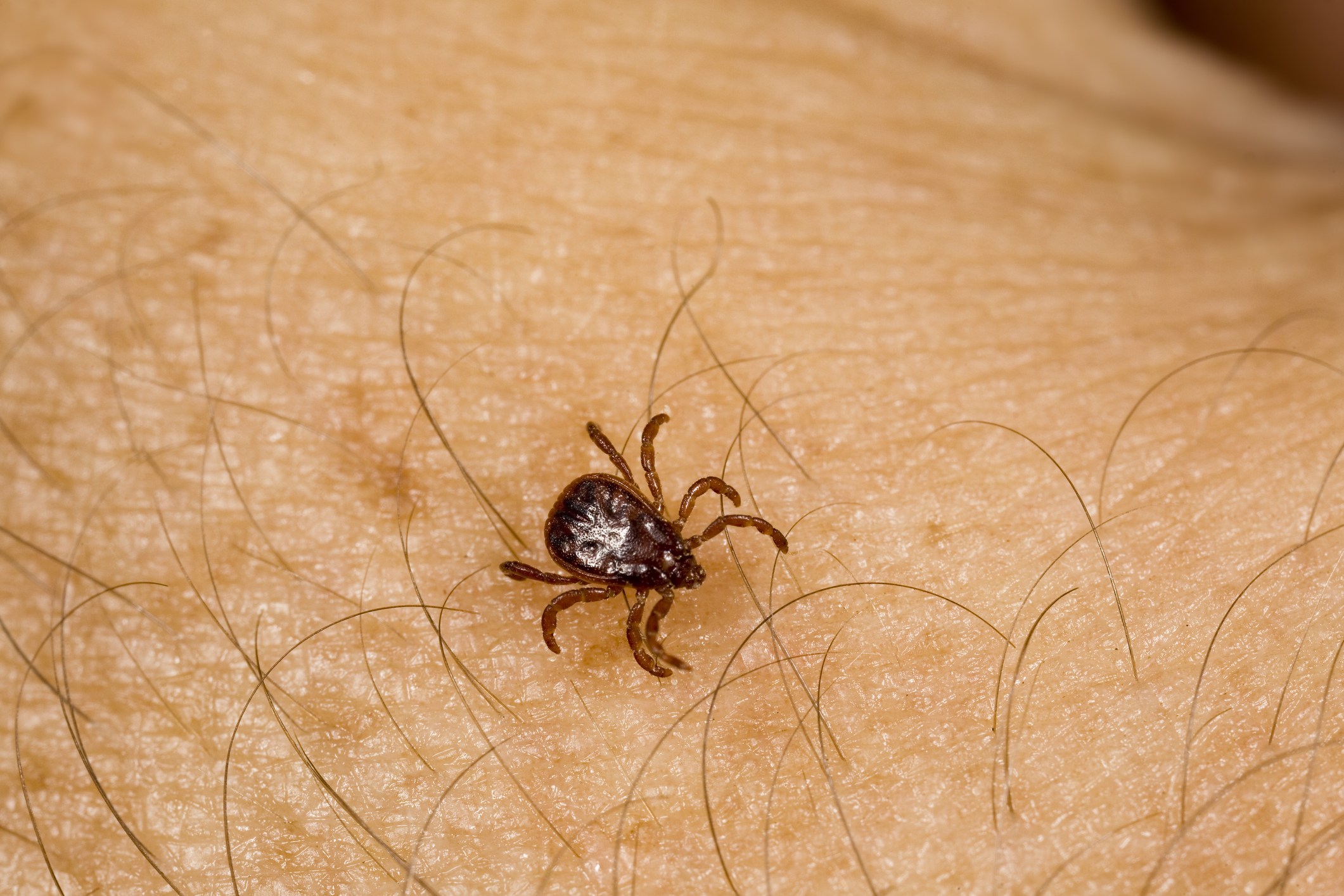 As Weather Patterns Shift, Ticks Populations Increase